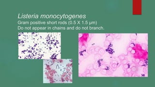 Gram Stain 2023 | PPT