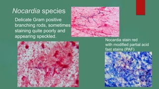 Gram Stain 2023 | PPT