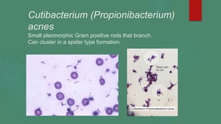 Gram Positive Pleomorphic Rods