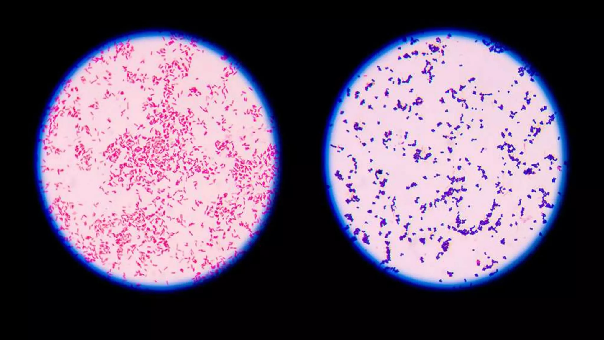 Gram staining | PPTX