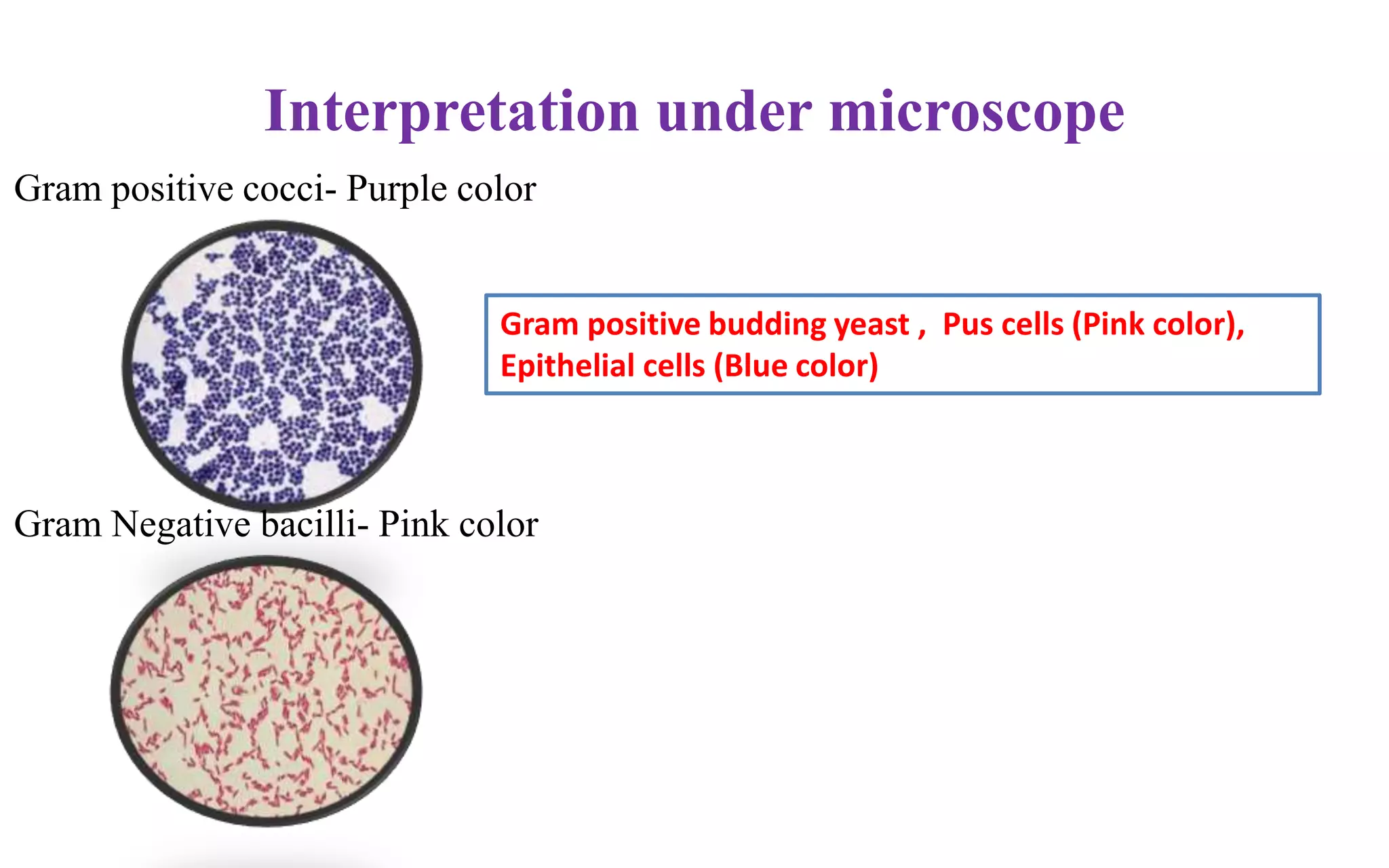 Gram staining | PPTX
