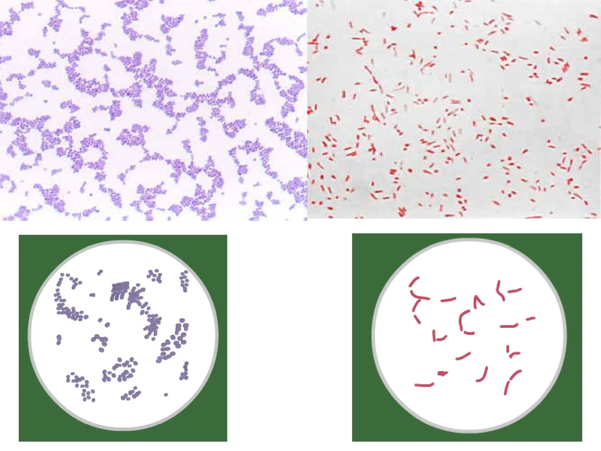 Gram staining Preliminary tool to diagnosing bacterial disease | PPTX