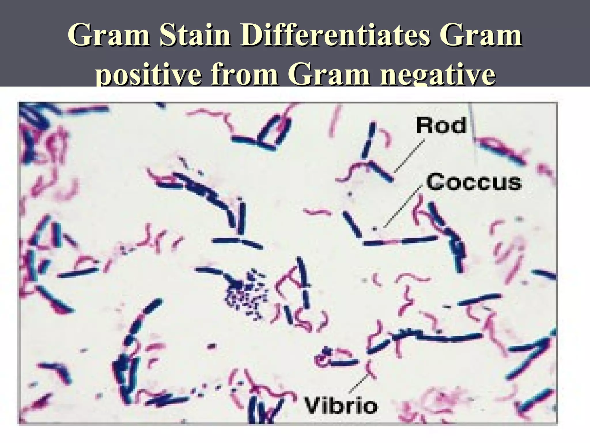 Gram staining altanzul | PPT