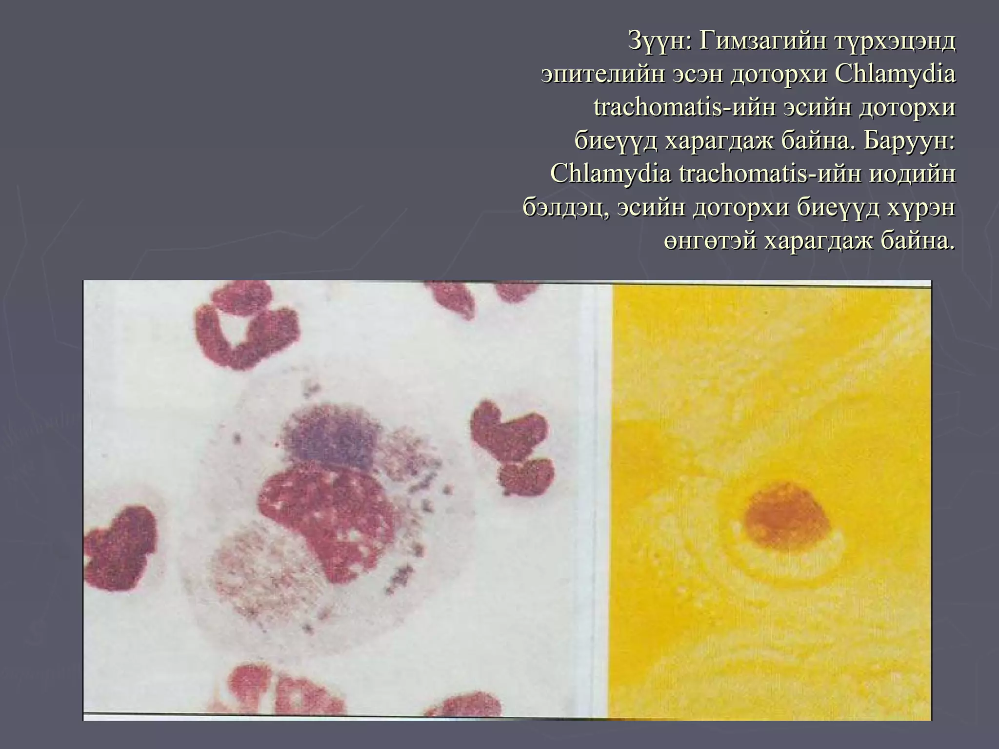 Gram Staining Altanzul Ppt