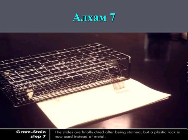 Gram staining altanzul | PPT