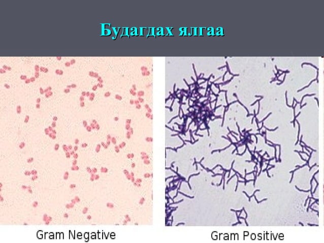 Gram staining altanzul | PPT
