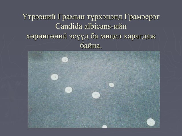 Gram staining altanzul | PPT