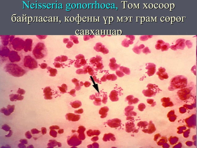 Gram staining altanzul | PPT