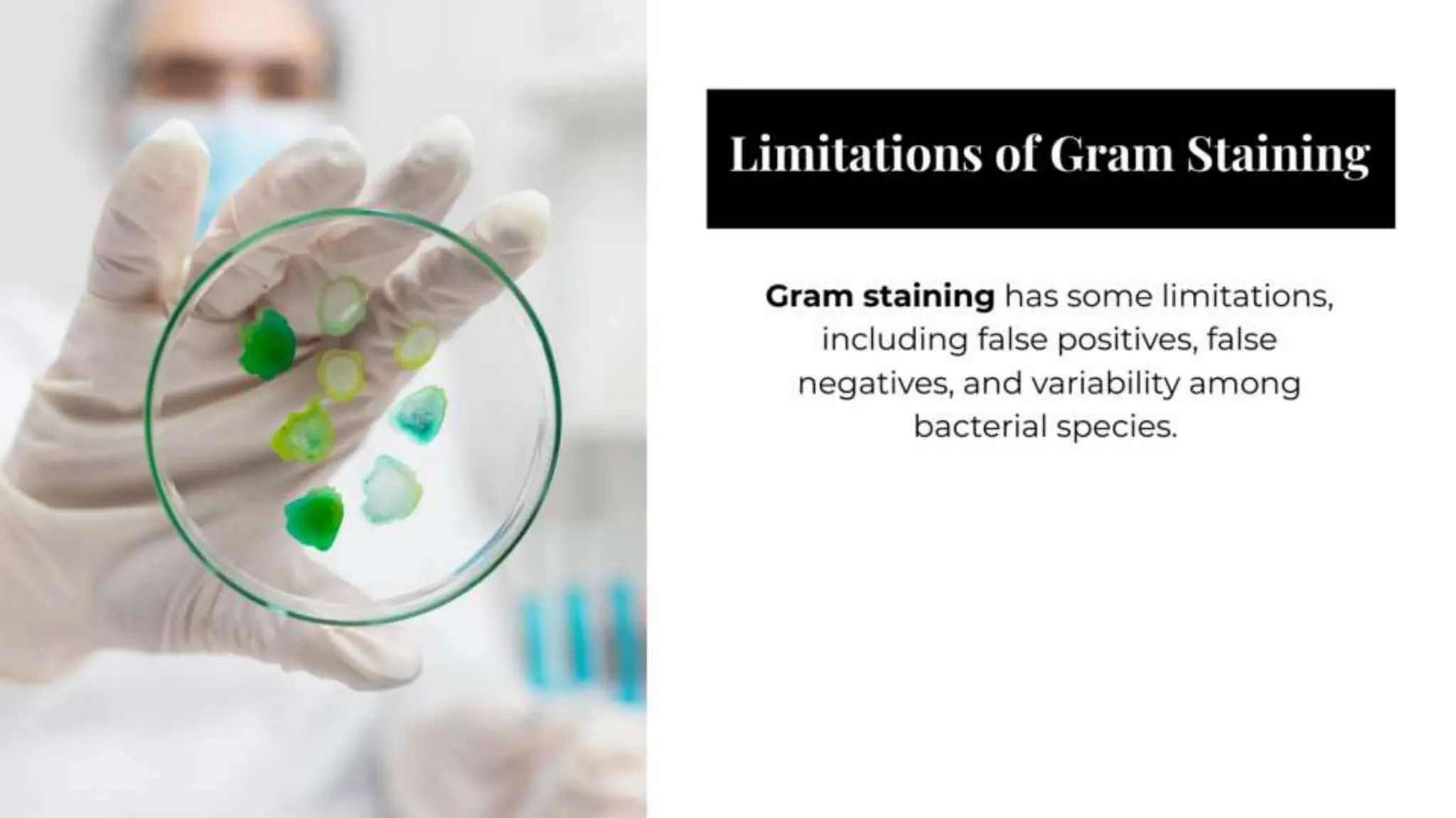Exploring Gram Staining: A Comprehensive Guide to Bacterial Cell Wall ...