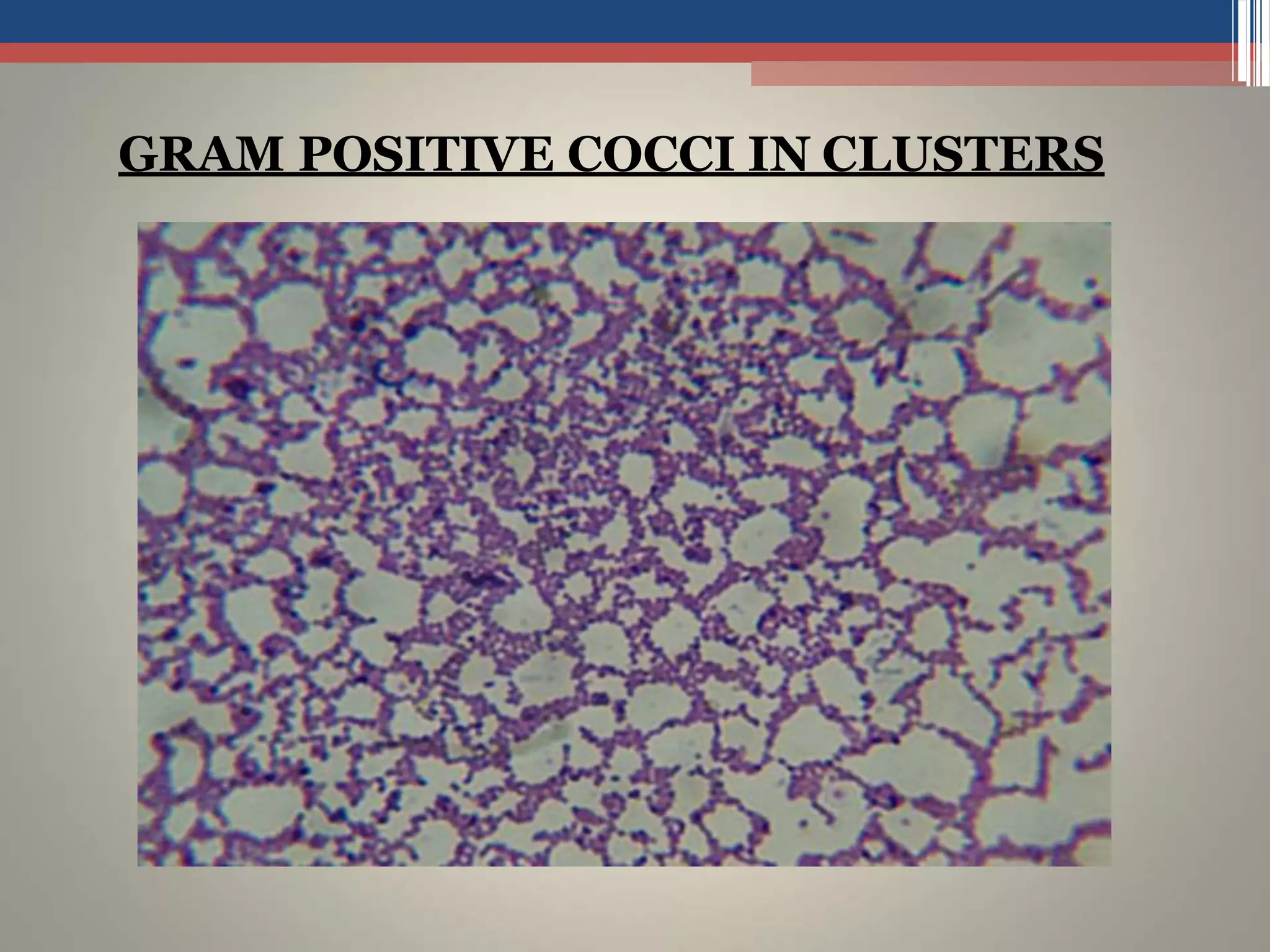 Gram staining technique.pptx