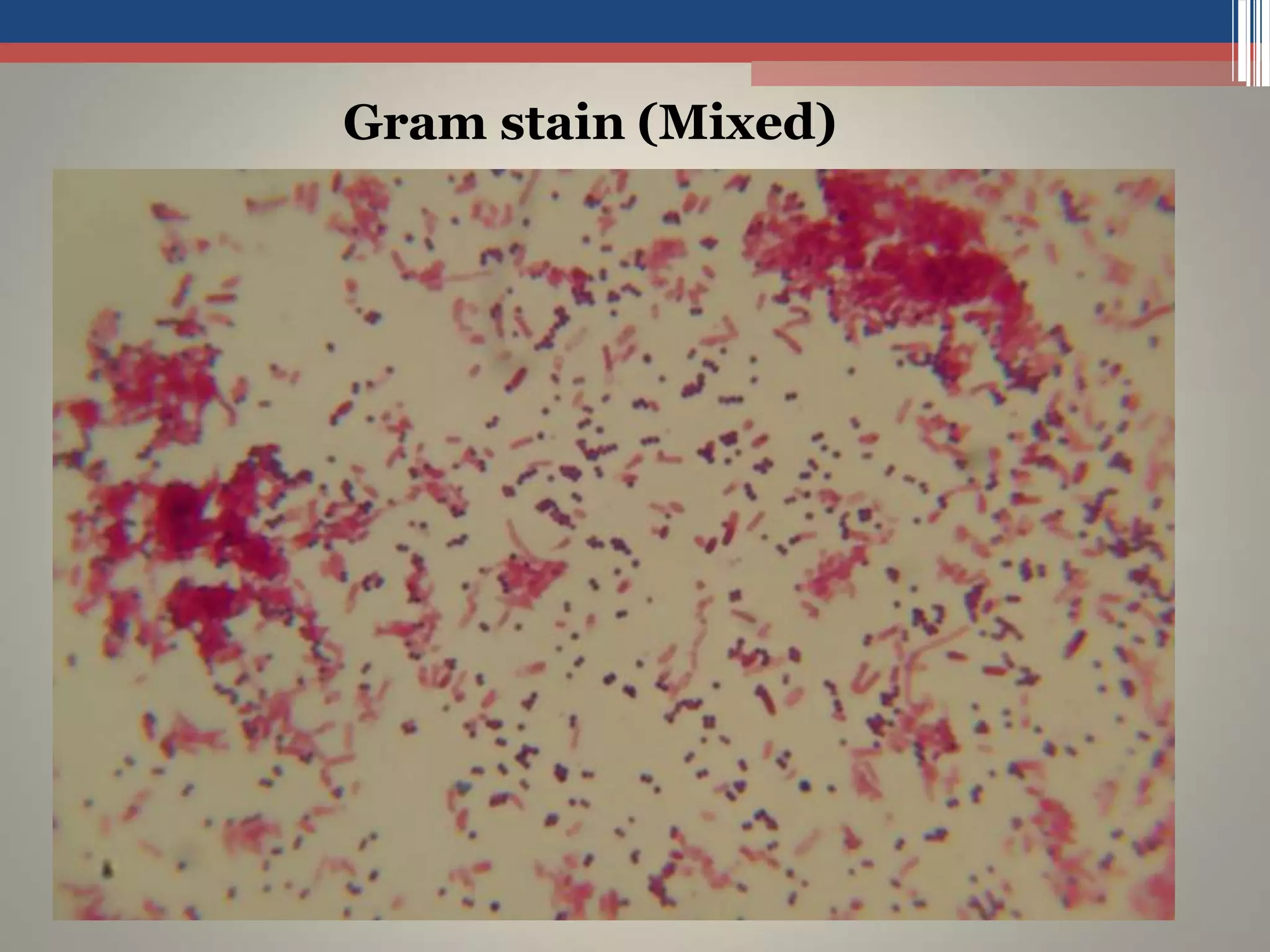 Gram staining technique.pptx
