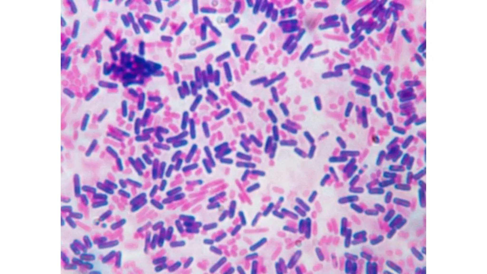 Gram staining technique for bacterial identification.ppt