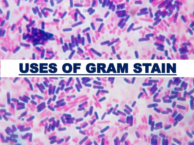 Presentation on Gram staining and modifications.pptx