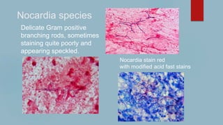 Gram Stains 2021 | PPT