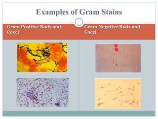 Gram stain | PPTX