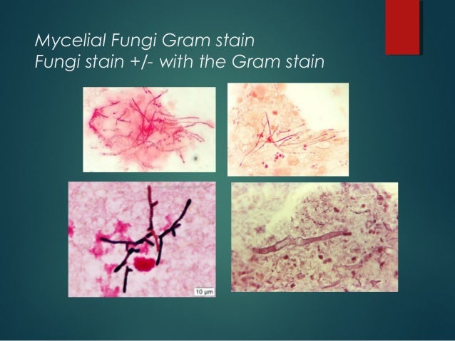 Gram Stains Update 2017