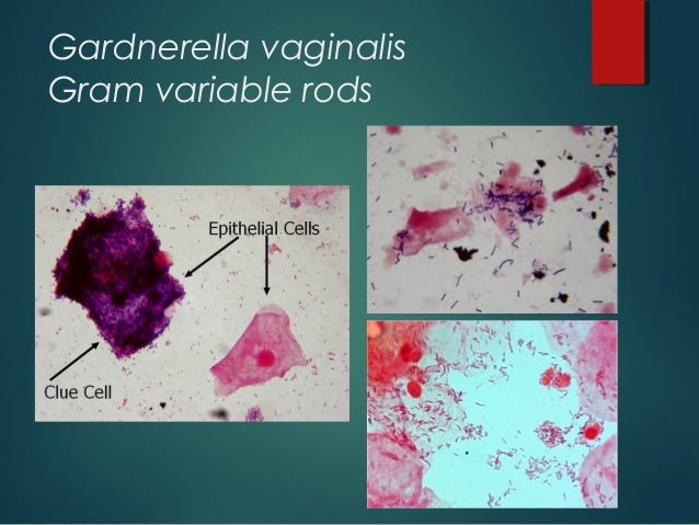 Gram Stains Update 2017