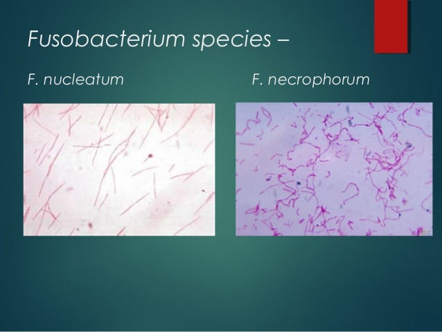Gram Stains Update 2017