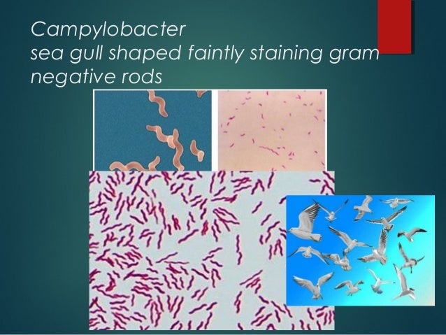 Gram Stains Update 2017