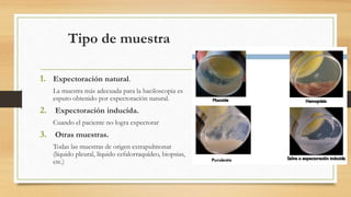 GRAM Y HONGOS.pptx