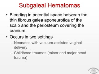 Hematoma subgaleal | PPTX