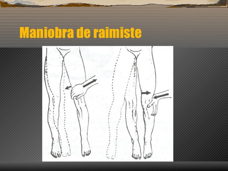 Grandes sindromes neurologicos