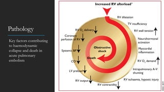 Grand Round 08.10.21 Massive PE - Thrombolysis | PPTX