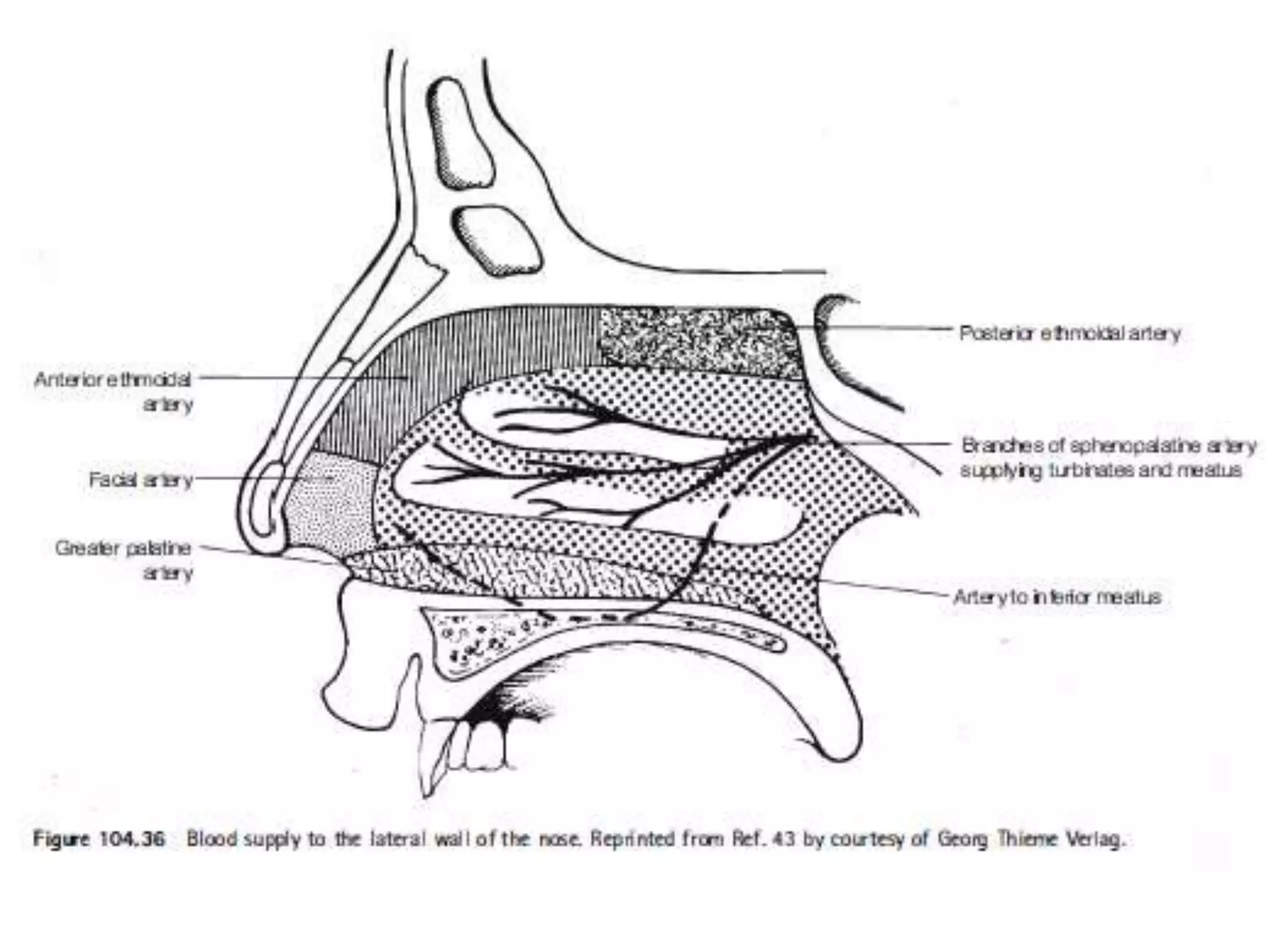 Epistaxis | PPT