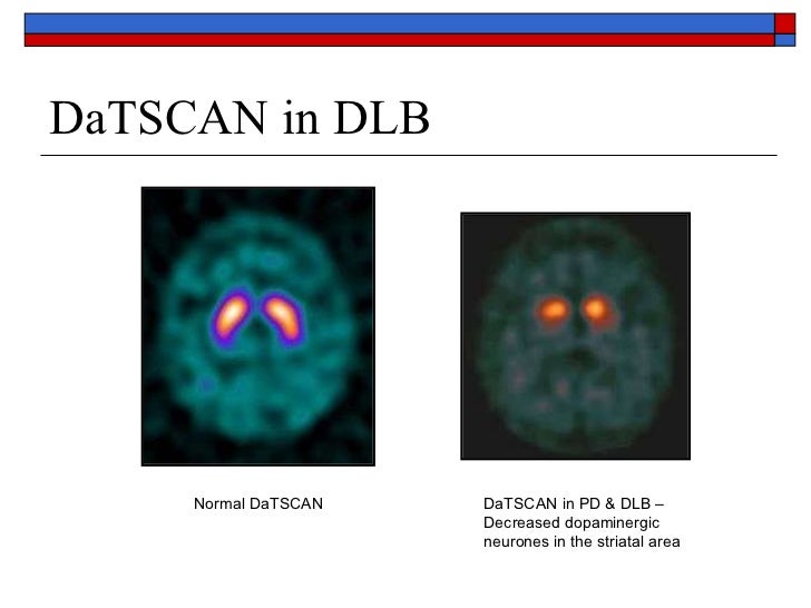 Medicine 5th year, 5th lecture (Dr. Asso Fariadoon Ali Amin)
