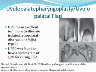Grand round obstructive sleep apnea in adults | PPTX