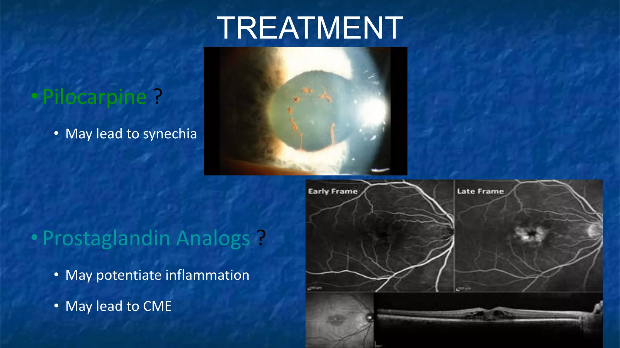 Ocular Grand rounds 2017 | PPT