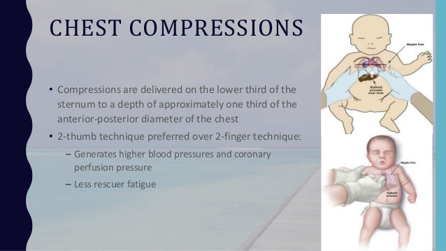Neonatal resuscitation