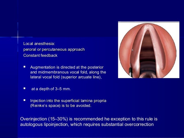 vocal cord paralysis