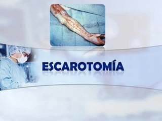 Escarotomía