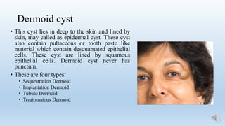 Granthi (cyst) | PPTX