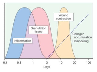 GRANULATION TISSUE.pptx