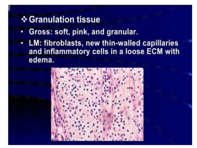 GRANULATION TISSUE.pptx
