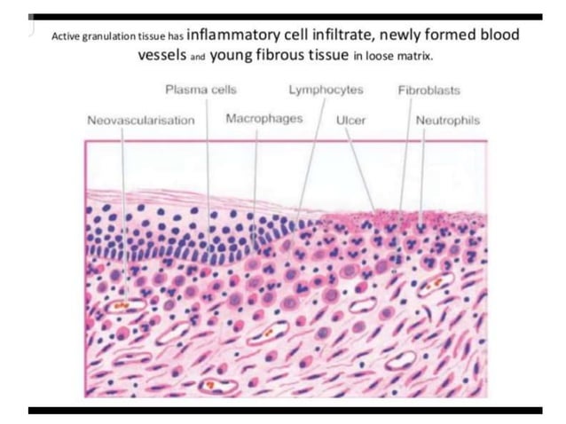 GRANULATION TISSUE.pptx