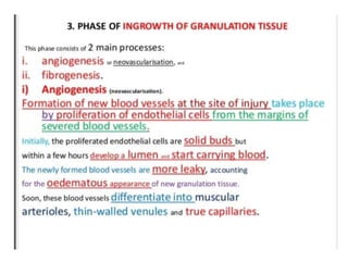 GRANULATION TISSUE.pptx