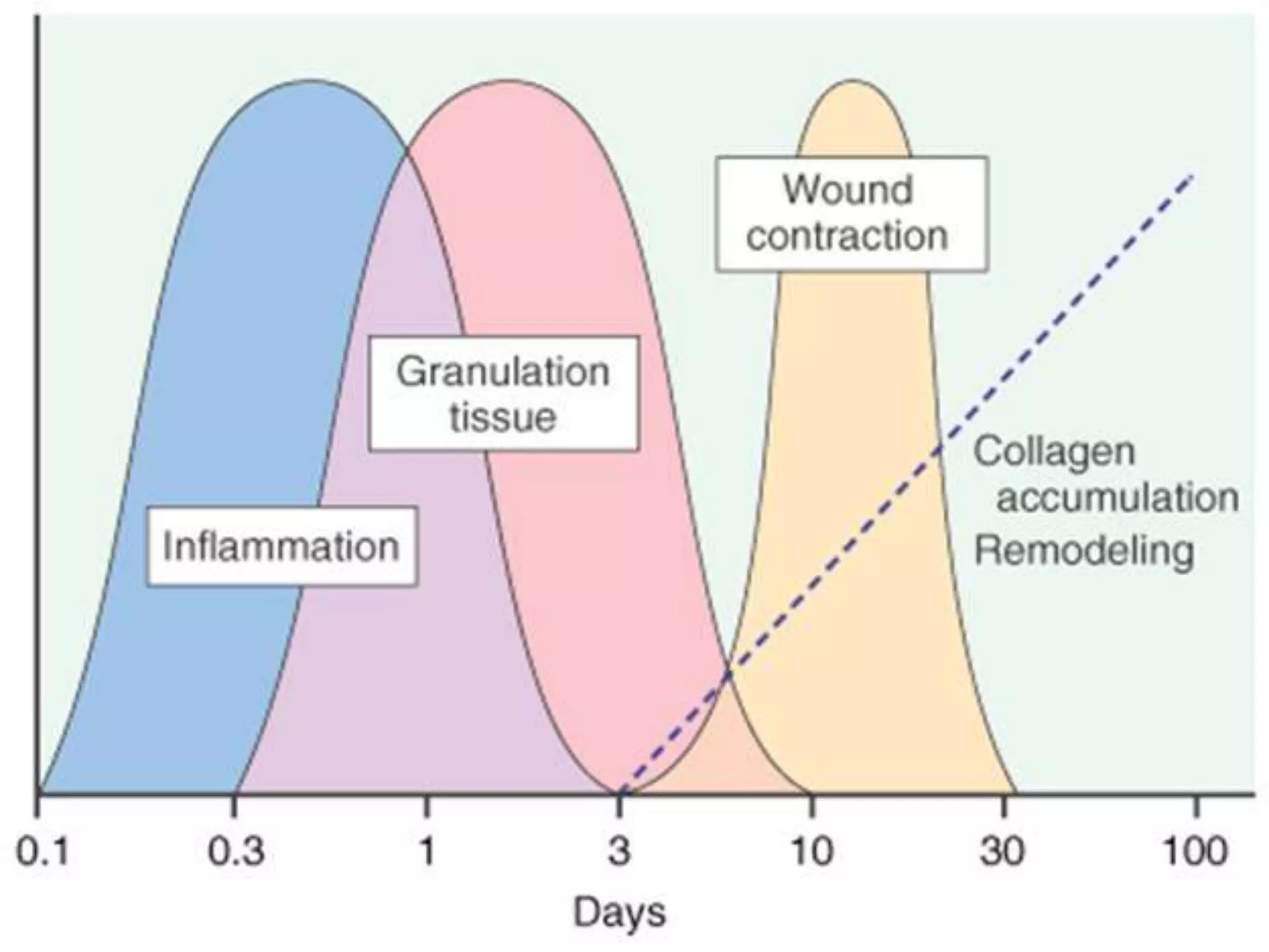 Granulation tissue formation | PPTX