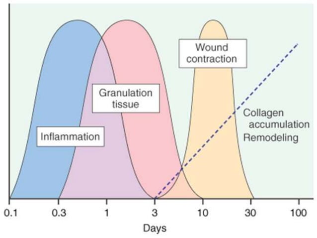 Granulation tissue formation | PPTX