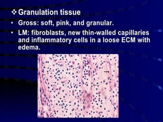 Granulation tissue formation | PPTX