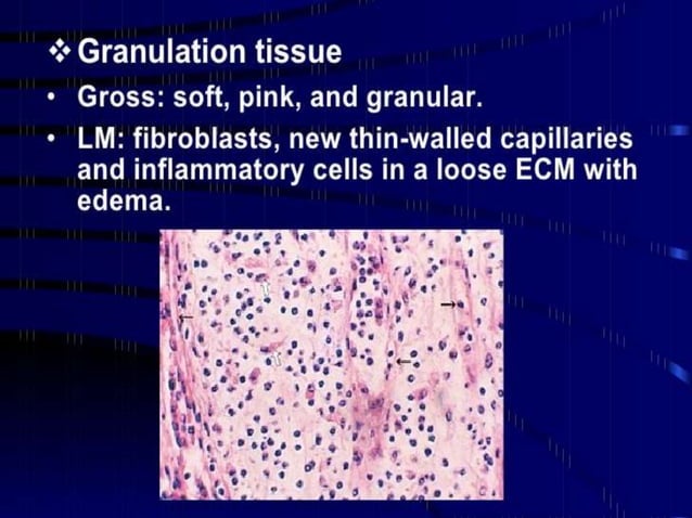 Granulation tissue formation