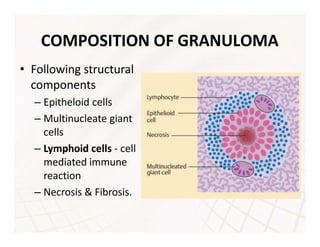 granuloma inflammation powerpoint presentation | PPTX