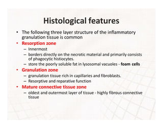 granuloma inflammation powerpoint presentation | PPTX