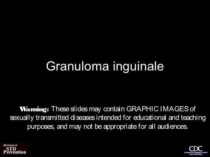 Granuloma Inguinale