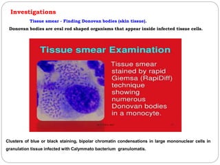 Granuloma inguinale (Donovanosis) | PPSX