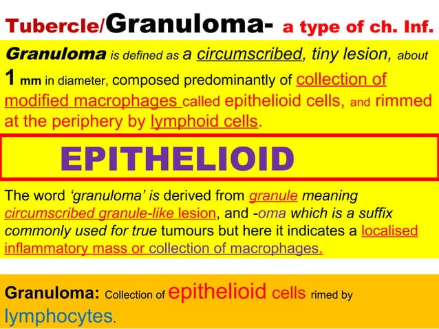 Granuloma lecture st | PPT | Lung and Respiratory Health | Diseases and ...