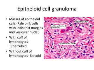 Granulomas Dr Manasa Shettisara Janney | PPTX