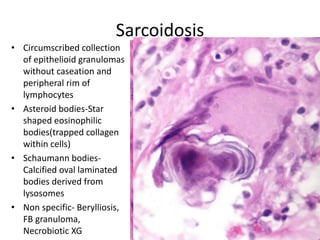 Schaumann And Asteroid Bodies